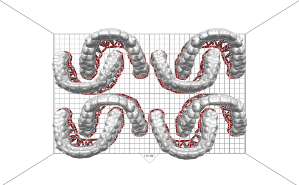 Direct Clear Printing Aligners - LuxCreo
